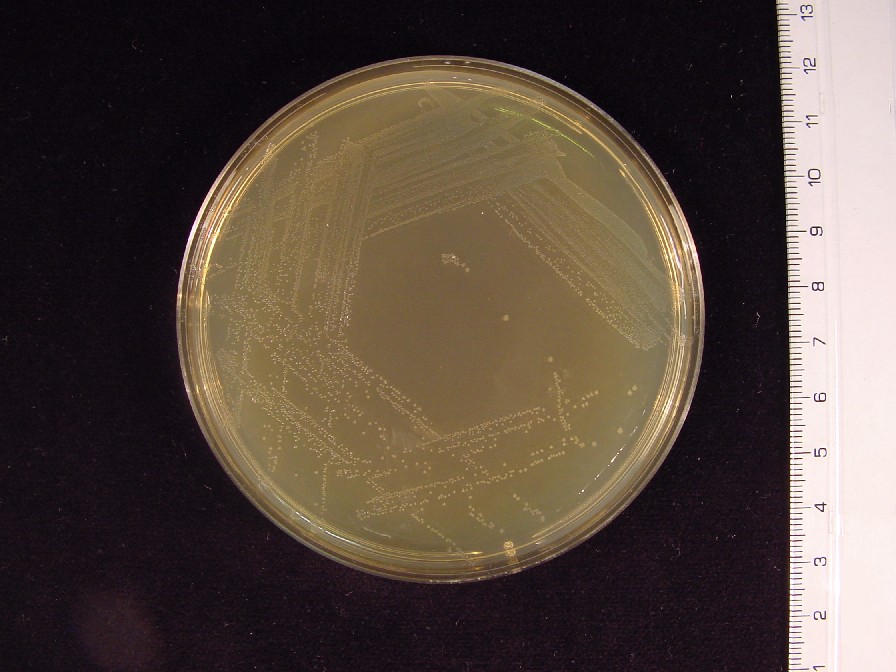 Miniatlas mikroorganismů