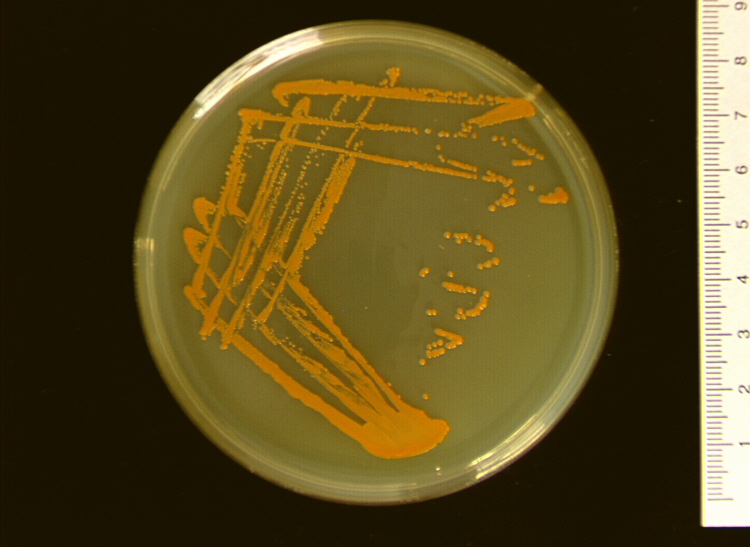 Miniatlas mikroorganismů
