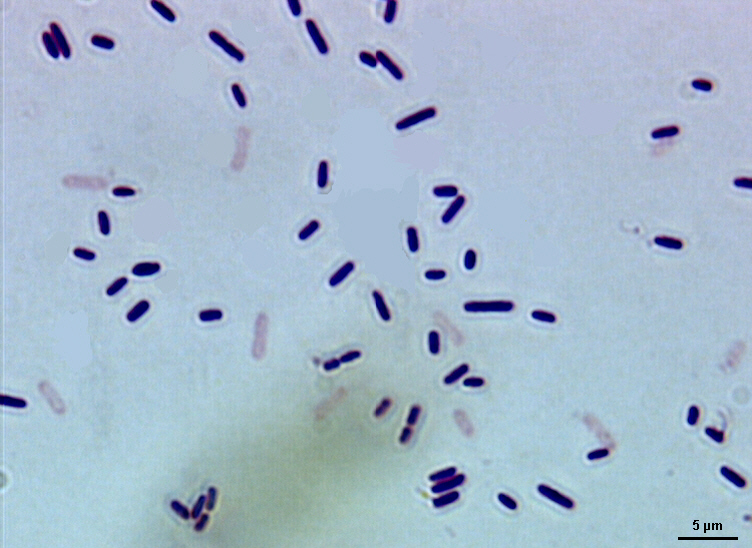 Bacillus sphaericus - Alchetron, The Free Social Encyclopedia